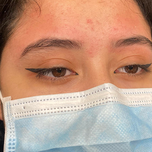 Eyelash Lift & Tint – Kiran's Esthetics Laser Eyelash Lift & Tint – Kiran's Esthetics Laser